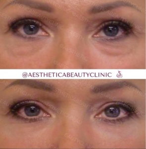Dr. Evija Rodke - Aesthetica.lv