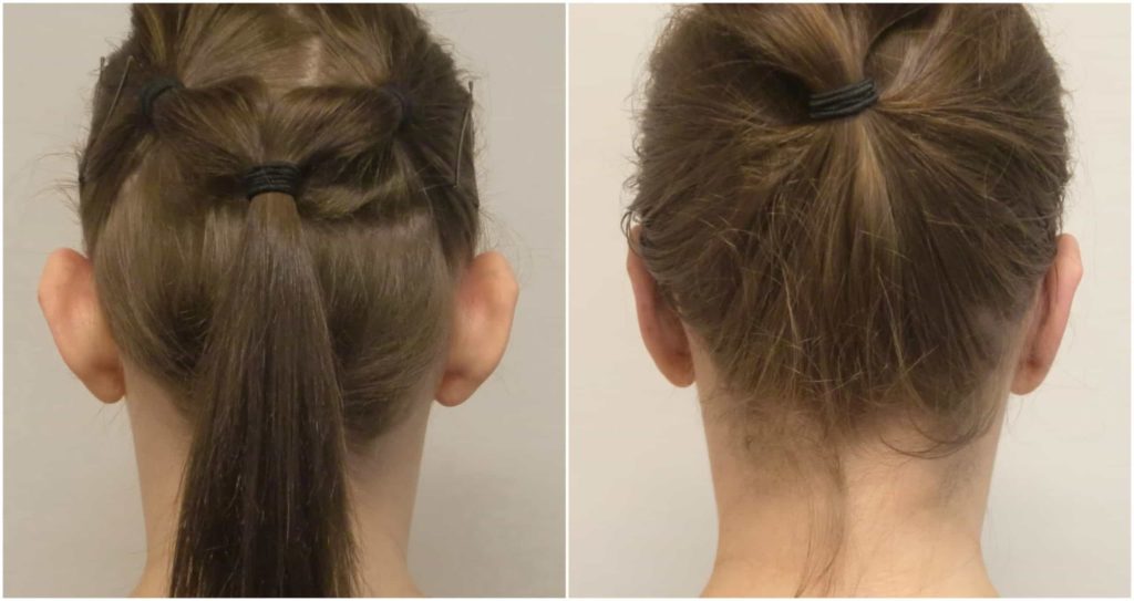 Plastiskā ķirurģija un estētiskā medicīna | Klīnika Aesthetica