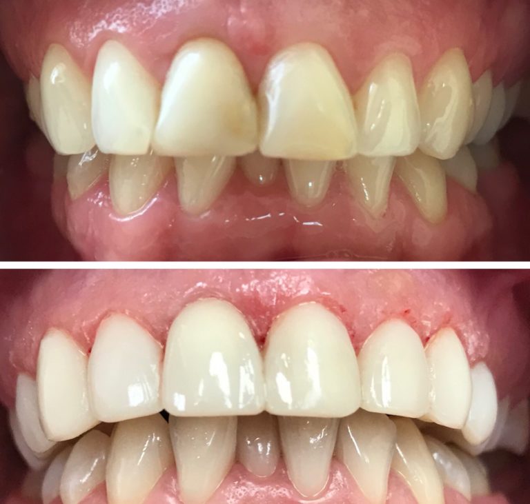 Zobārstniecība un Zobu Higiēnists Rīgā | Aesthetica