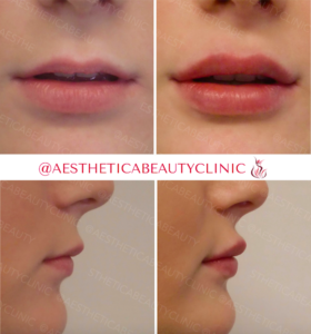 Dr. Evija Rodke - Aesthetica.lv