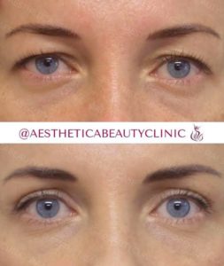 Dr. Evija Rodke - Aesthetica.lv