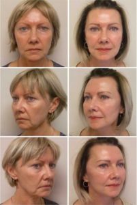 Dr. Evija Rodke - Aesthetica.lv